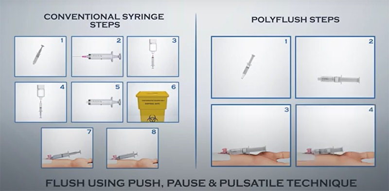 Advantages of Prefilled Syringes Compared to Conventional Syringes for ...